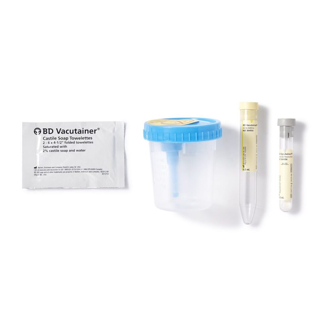 BD Vacutainer Urine Specimen Collection Kit - Med Global Shop is a ...